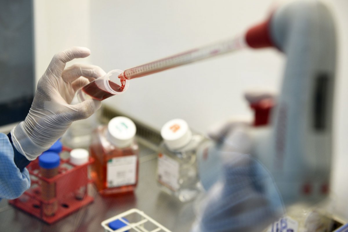 Supporting the ME/CFS Biobank | Your gift in action | LSHTM